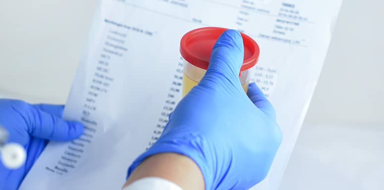Reliability of BAC Tests: BAC Urine Test / Urinalysis | LHA